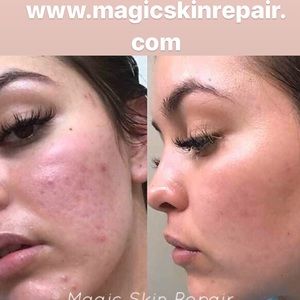 Magic Skin Repair | Other | Magic Skin Repair Oil | Poshmark